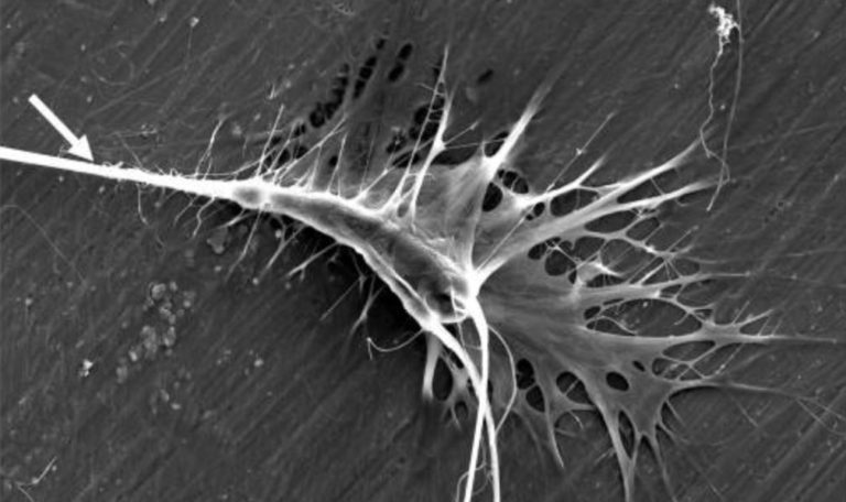 Science of Spider Silk - Charged Magazine